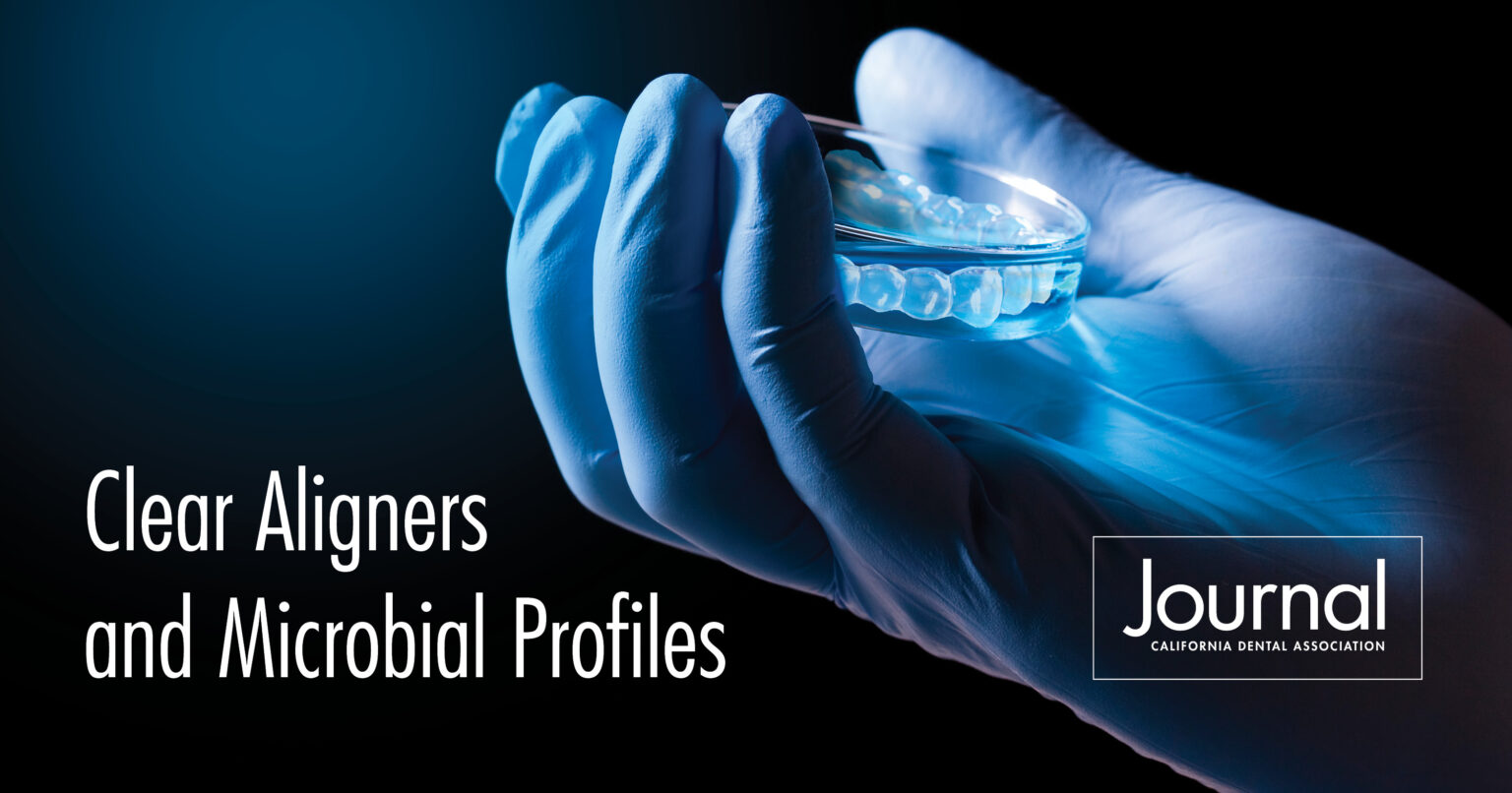 Clear aligners and microbial profiles examined in CDA Journal - CDA